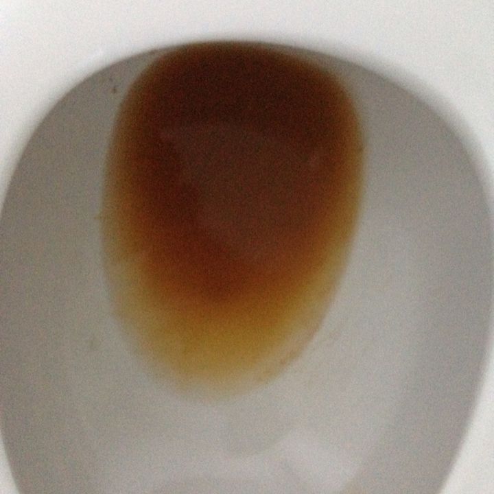 Diarrhea with a loud fart sound and a wet sound.