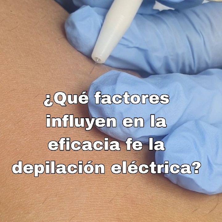 Todo Sobre Depilación Eléctrica