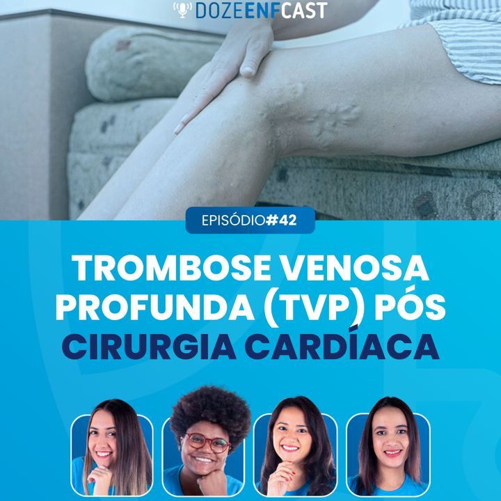 42 - TRMBOSE VENOSA PROFUNDA (TVP) Pós Cirurgia Cardíaca