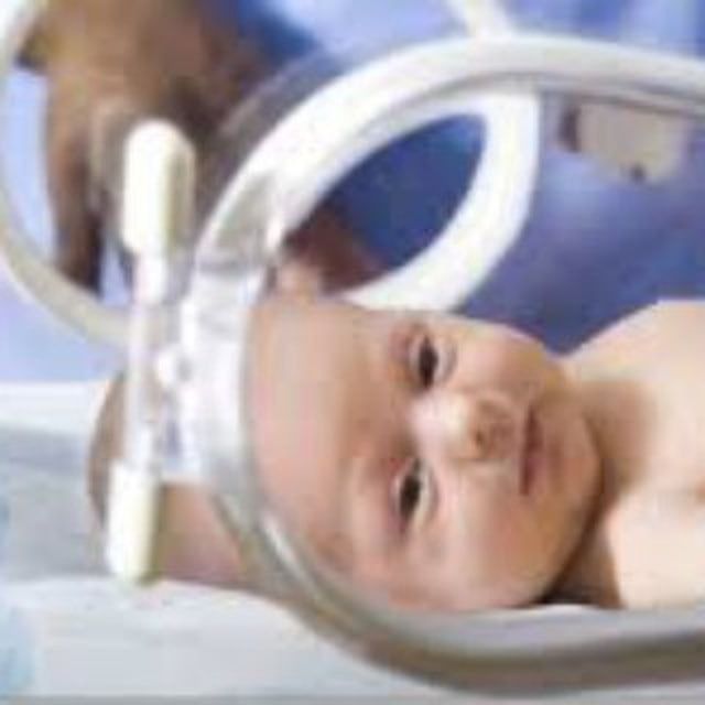 Neonatal high-frequency oscillatory ventilation where are we now